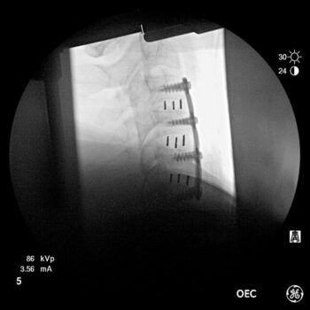 Structural Encoding - Nvision Biomedical Technologies