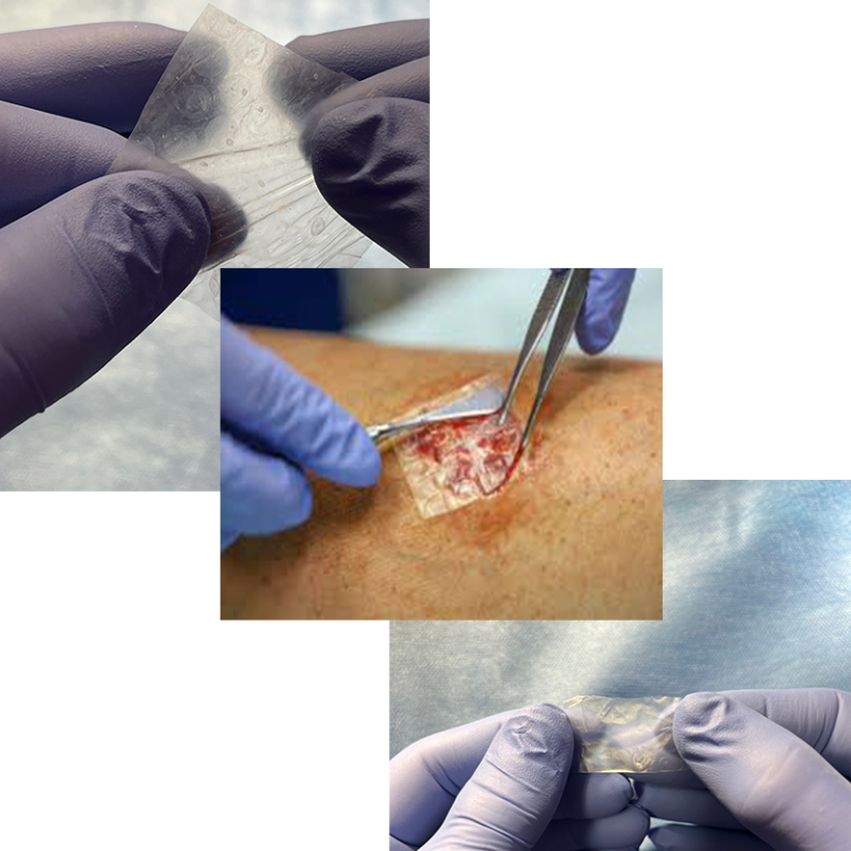 Palisade- DM Matrix - Nvision Biomedical Technologies 30